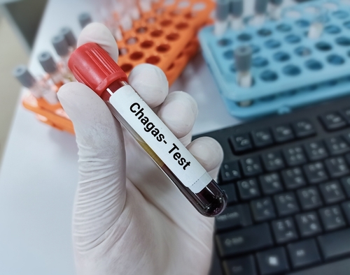 Más de 600 mil personas viven con la enfermedad de Chagas en Bolivia